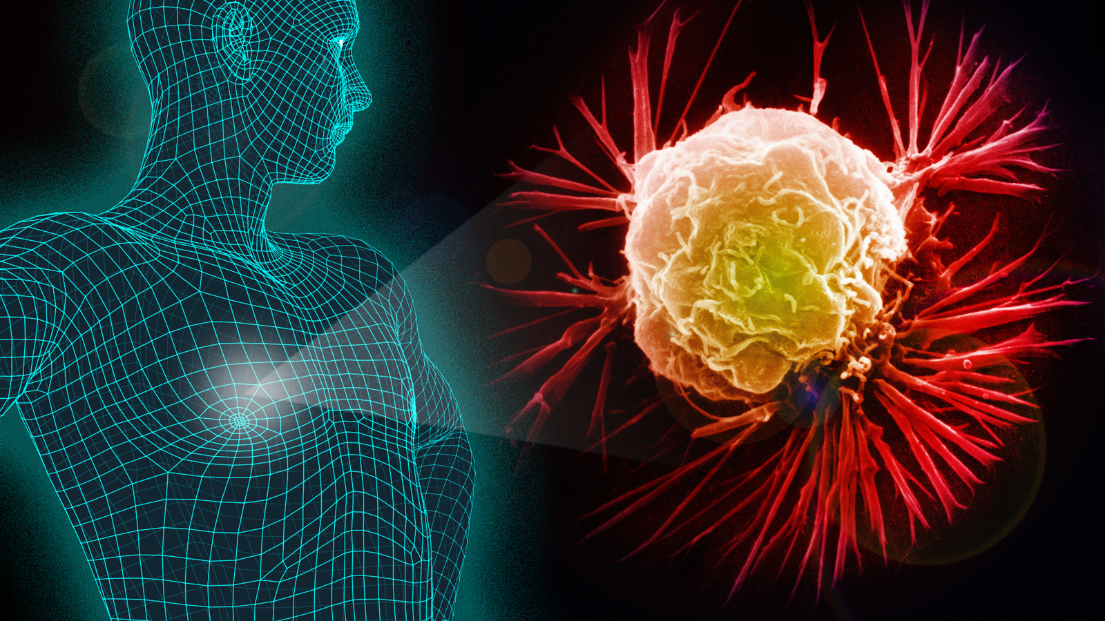 Myths and Misconceptions about Cancer - LAKESHORE CANCER CENTER